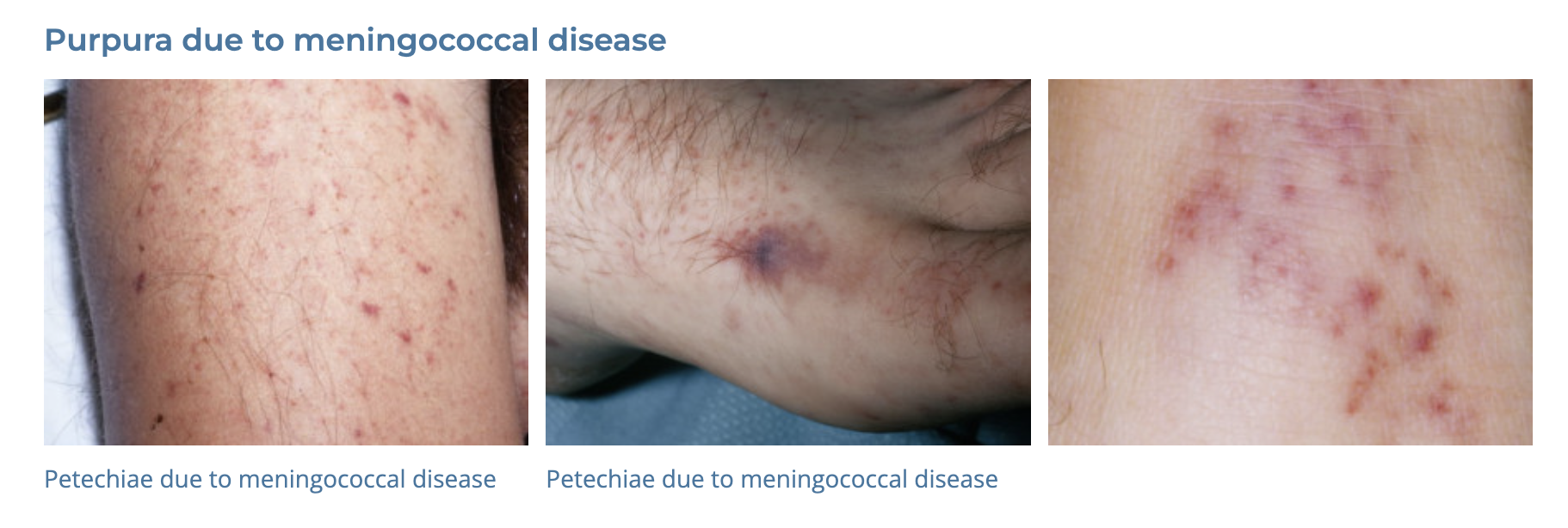 Skin Symptom NOS - GP Exams