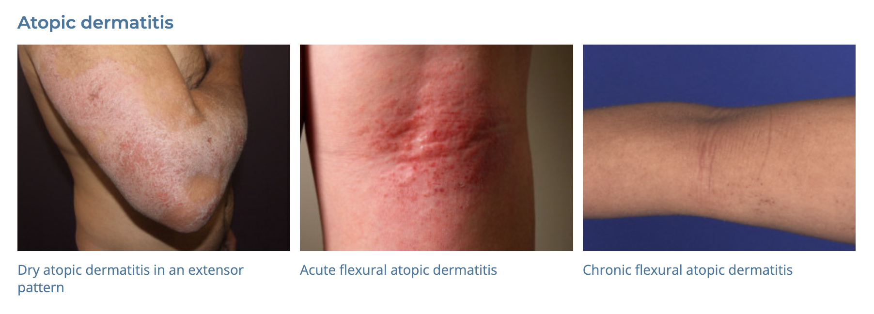 Dermatology - 101 - Conditions-01-20 - GP Exams
