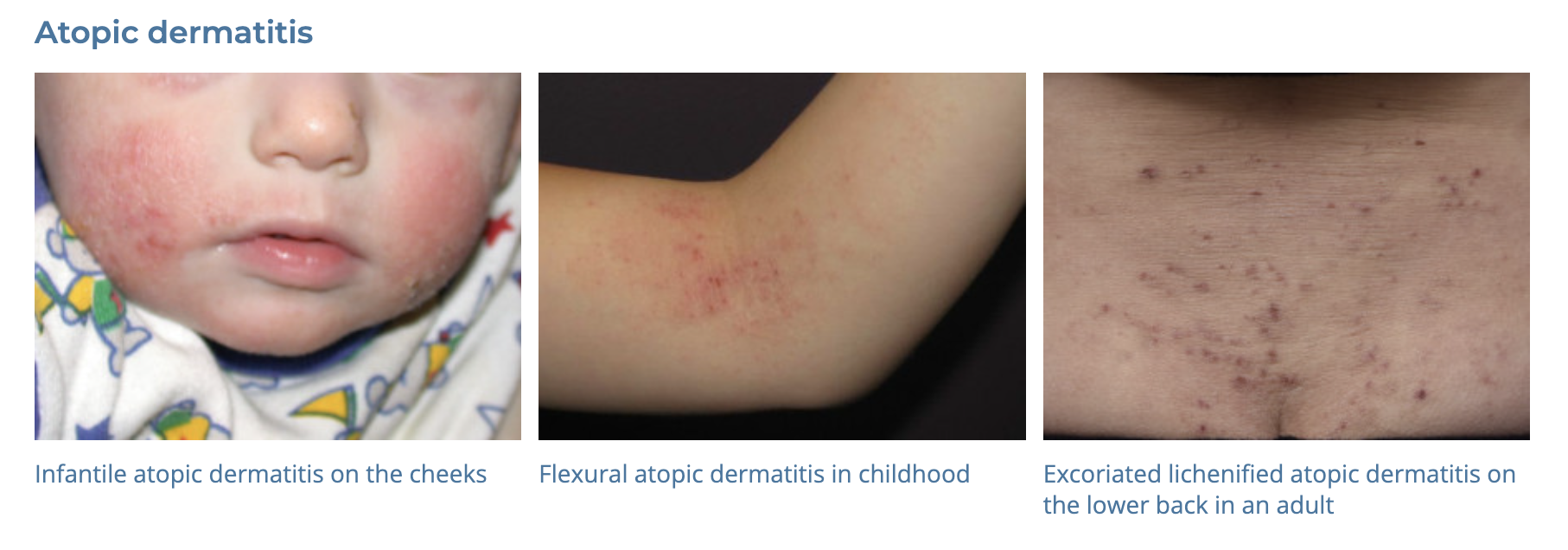 Dermatology - 101 - Conditions-01-20 - GP Exams